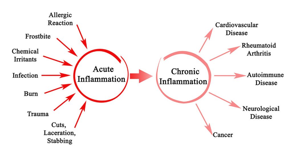 Inflammaging And What It Means For You Dr Jim Collins